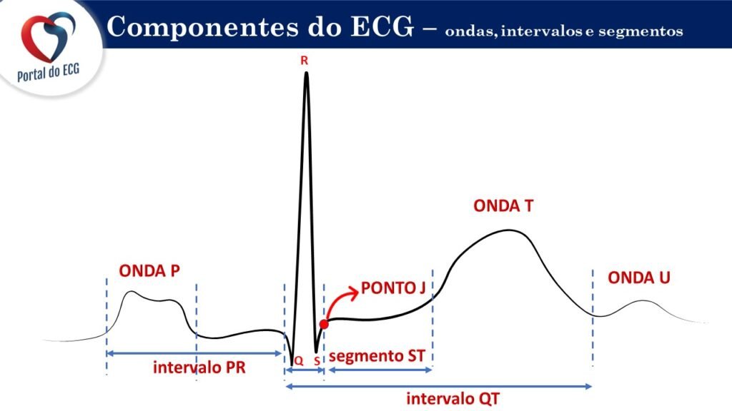 Portal do ECG